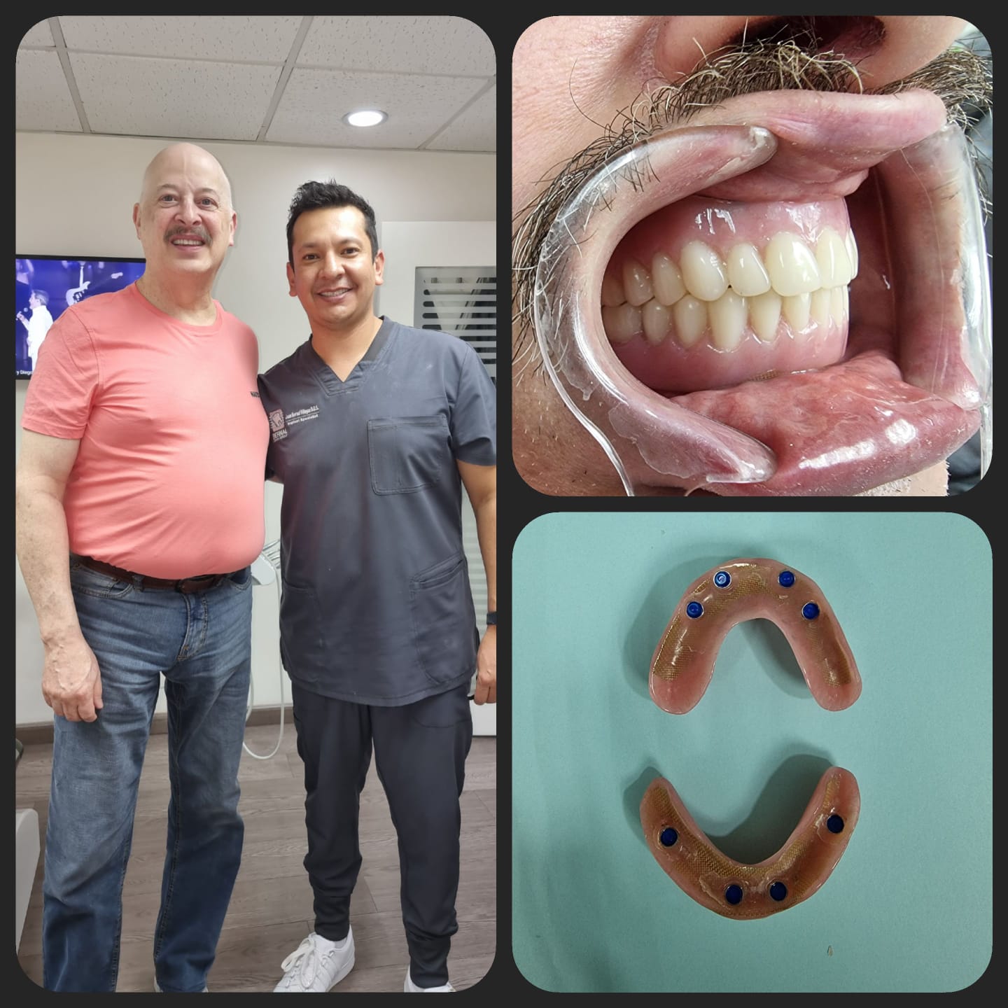 Bernal Dental Group